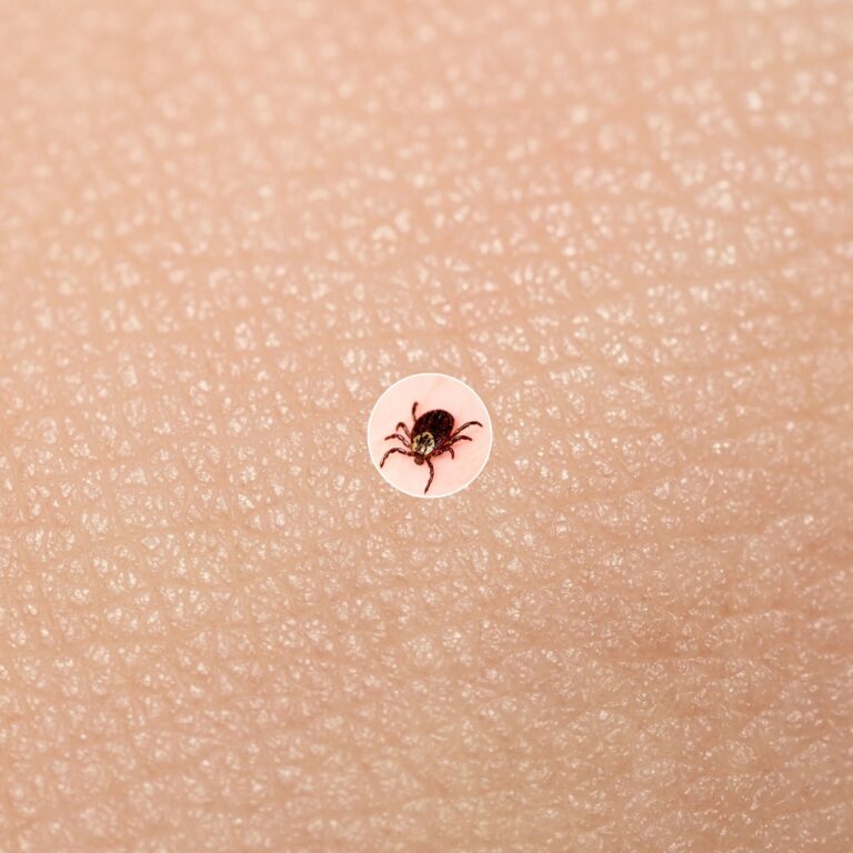 Tee päivittäin tärkeä punkkitarkastus – pelkkä punkin purema ei yleensä ...